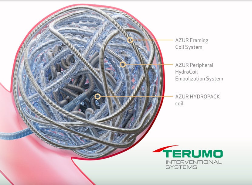 TERUMO LAUNCHES NEW AZUR HYDROPACK™ PERIPHERAL COIL SYSTEM | Medical ...