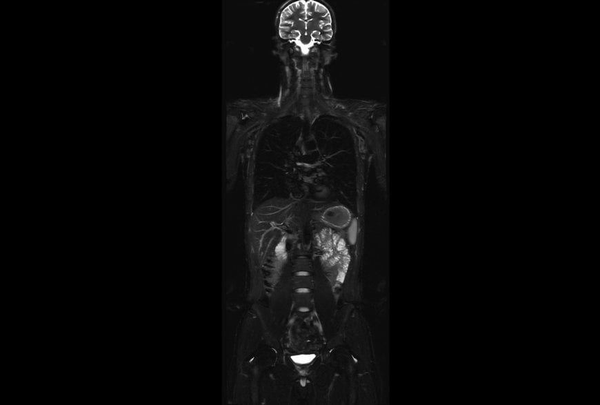 SIEMENS HEALTHINEERS INTRODUCES MAGNETOM FLOW FOR GREATER ...