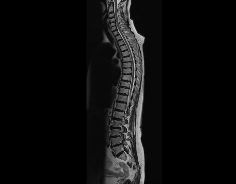 SIEMENS HEALTHINEERS INTRODUCES MAGNETOM FLOW FOR GREATER ...