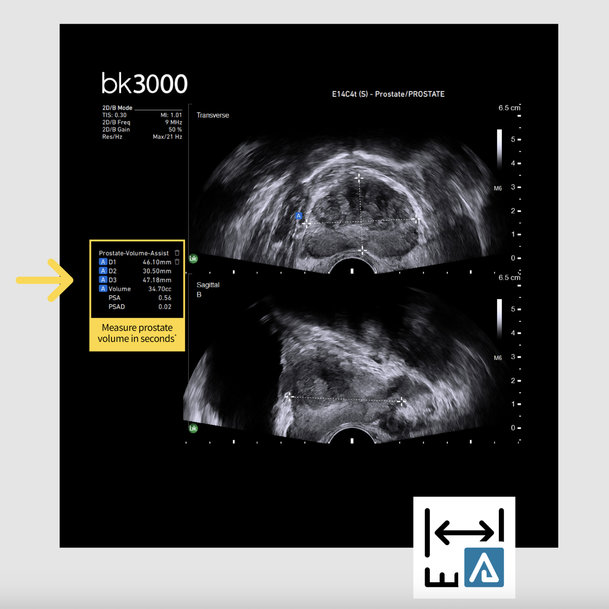 GE HEALTHCARE UNVEILS AI-ENABLED UROLOGY SOFTWARE FEATURE PROSTATE ...