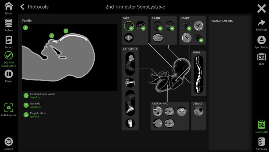 GE HEALTHCARE INTRODUCES AI-ENHANCED VOLUSON SIGNATURE 20 AND 18 ...