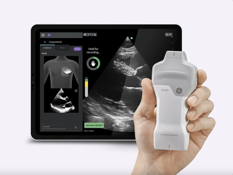 GE HealthCare showcases latest AI-enhanced cardiology solutions to ...